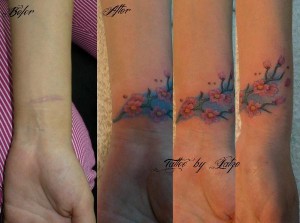 Vrei să scapi de o cicatrice? Ascunde-o într-un tatuaj! (foto)